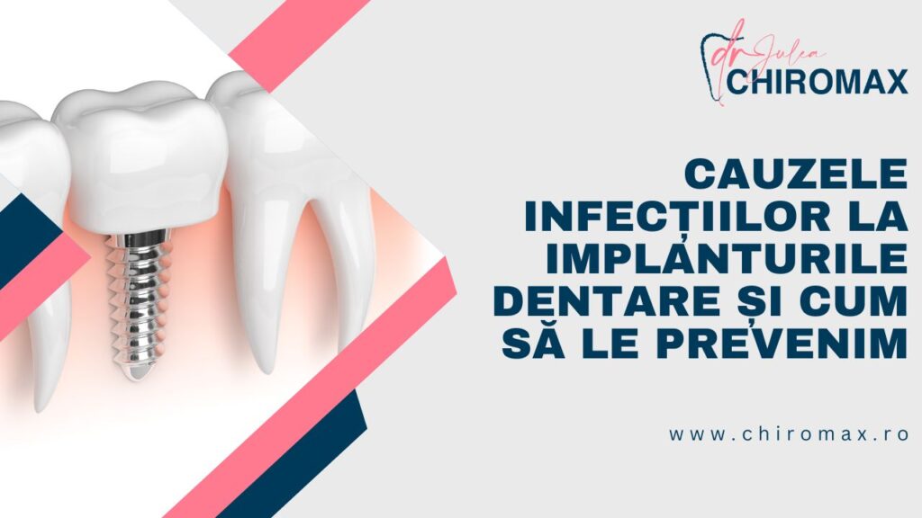 Cauzele Infecțiilor La Implanturile Dentare Și Cum Să Le Prevenim ...